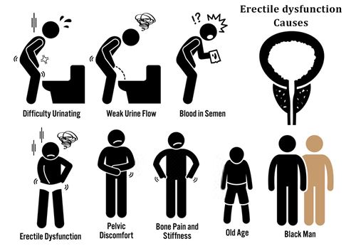 How Can know you have Erectile Dysfunction?